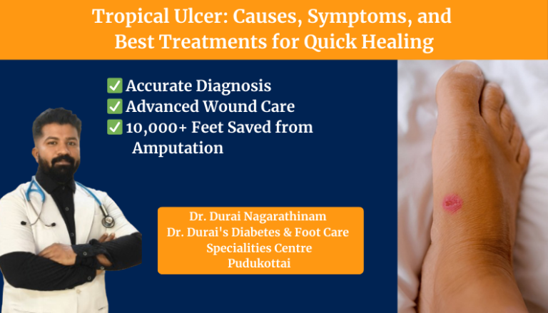 Tropical Ulcer: Causes, Symptoms, and Best Treatments for Quick Healing